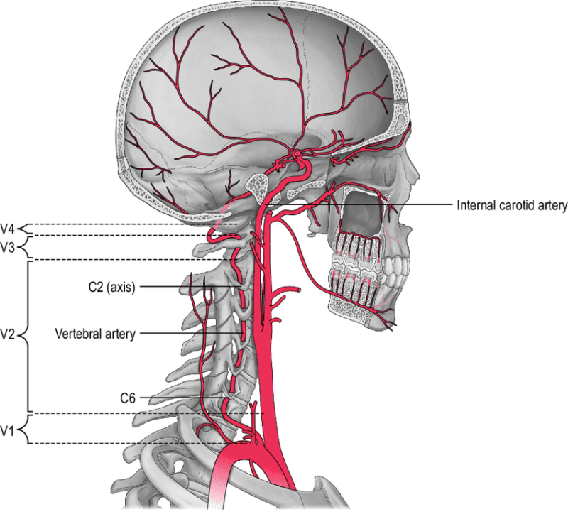 Carotid Occlusive Artery Disease - Carotid Artery Stenosis - Neuropedia