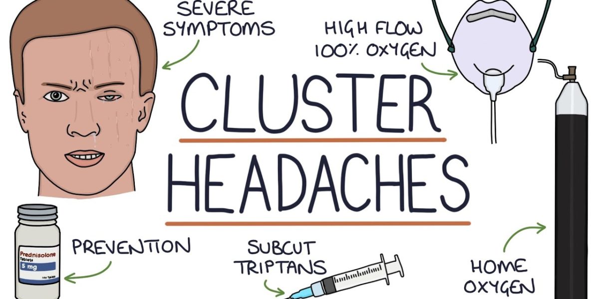 Cluster Headache - Neuropedia