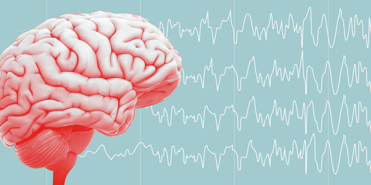 Acute Symptomatic Seizures - Neuropedia