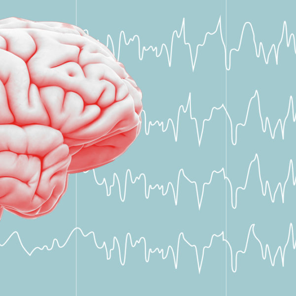 History of Epilepsy - Neuropedia