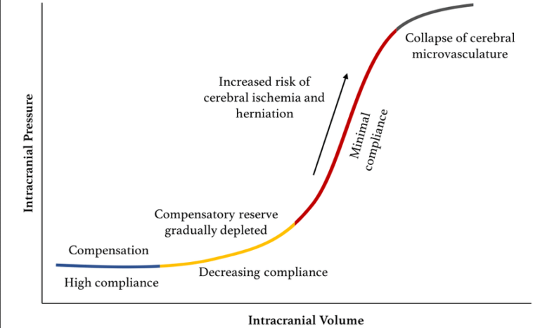 ICP Monitoring: Types and Indications - Neuropedia