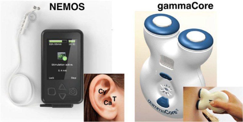 Vagus Nerve Stimulation (VNS) - Neuropedia